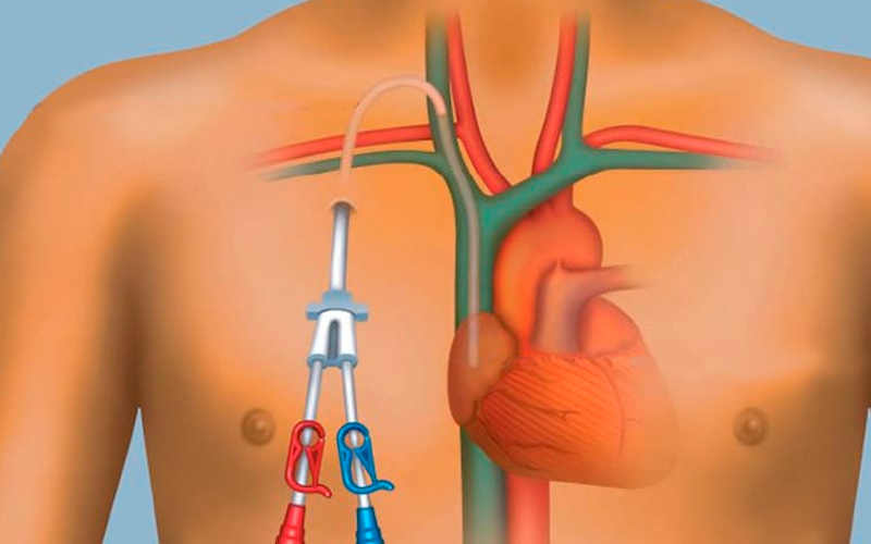 Bienvenidos Angio Vascular Dr Kelbrth Camas